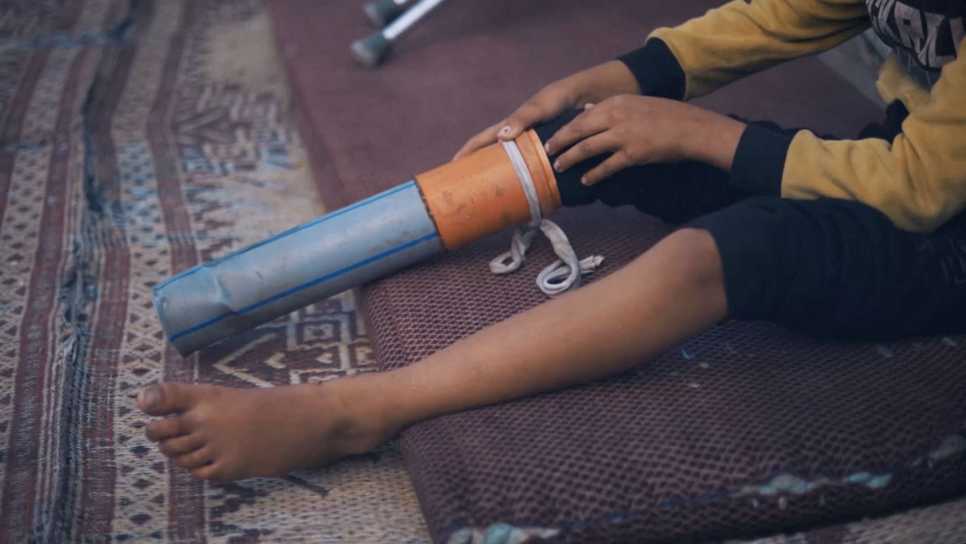 Den Amputerede Fremtid